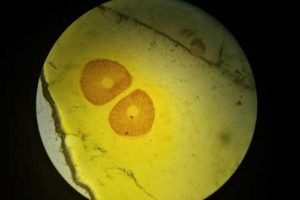 Oestrus ovis and its zoonotic importance – epashupalan
