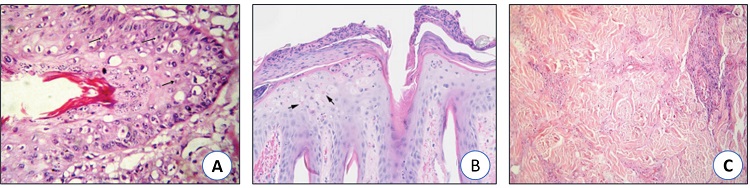 Lumpy Skin Disease: An emerging threat to Cattle and Buffalo – epashupalan